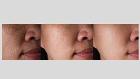 Solution for skin lightening